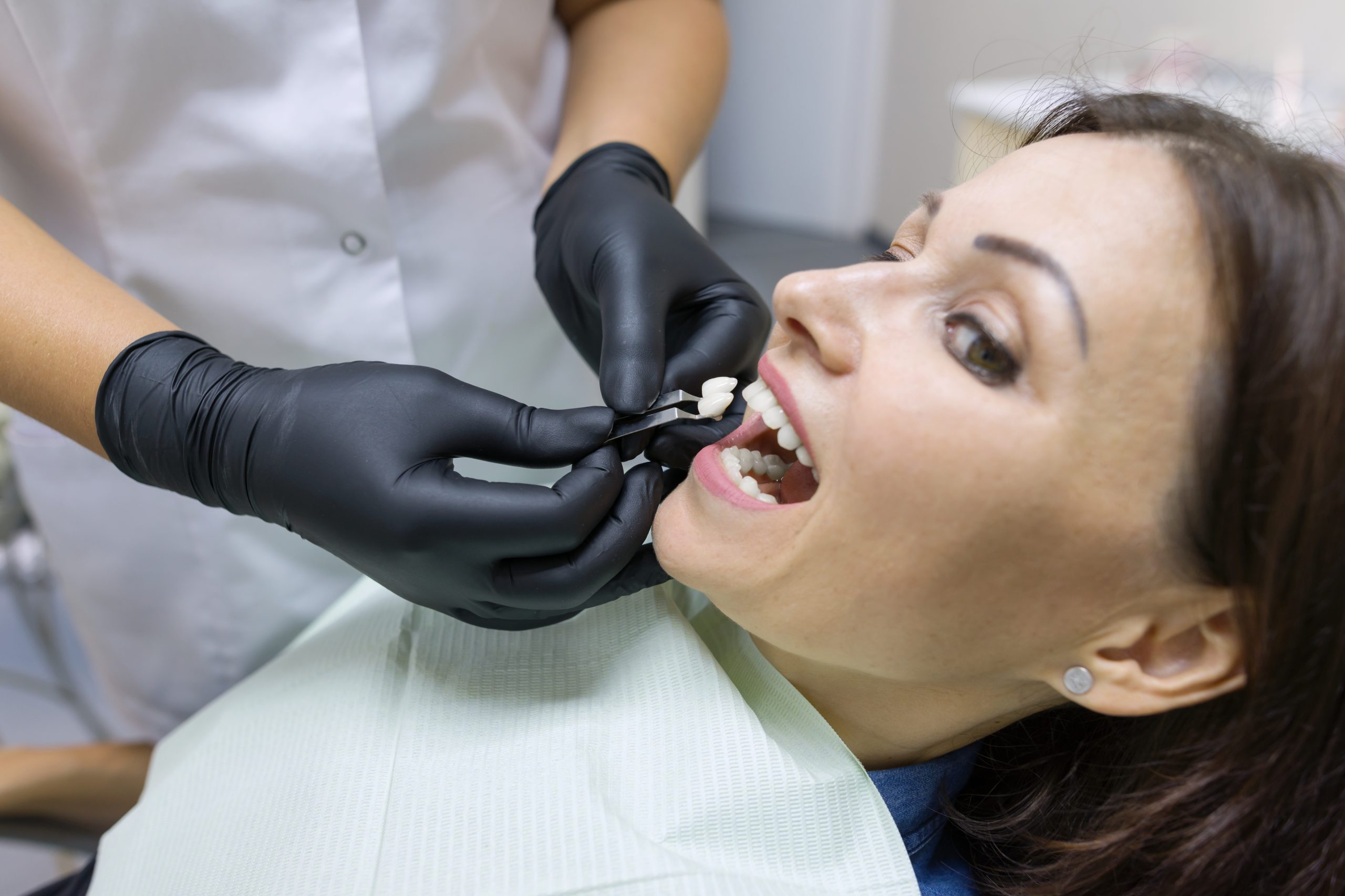 Inlays and Onlays - Perfect Teeth Dental NY